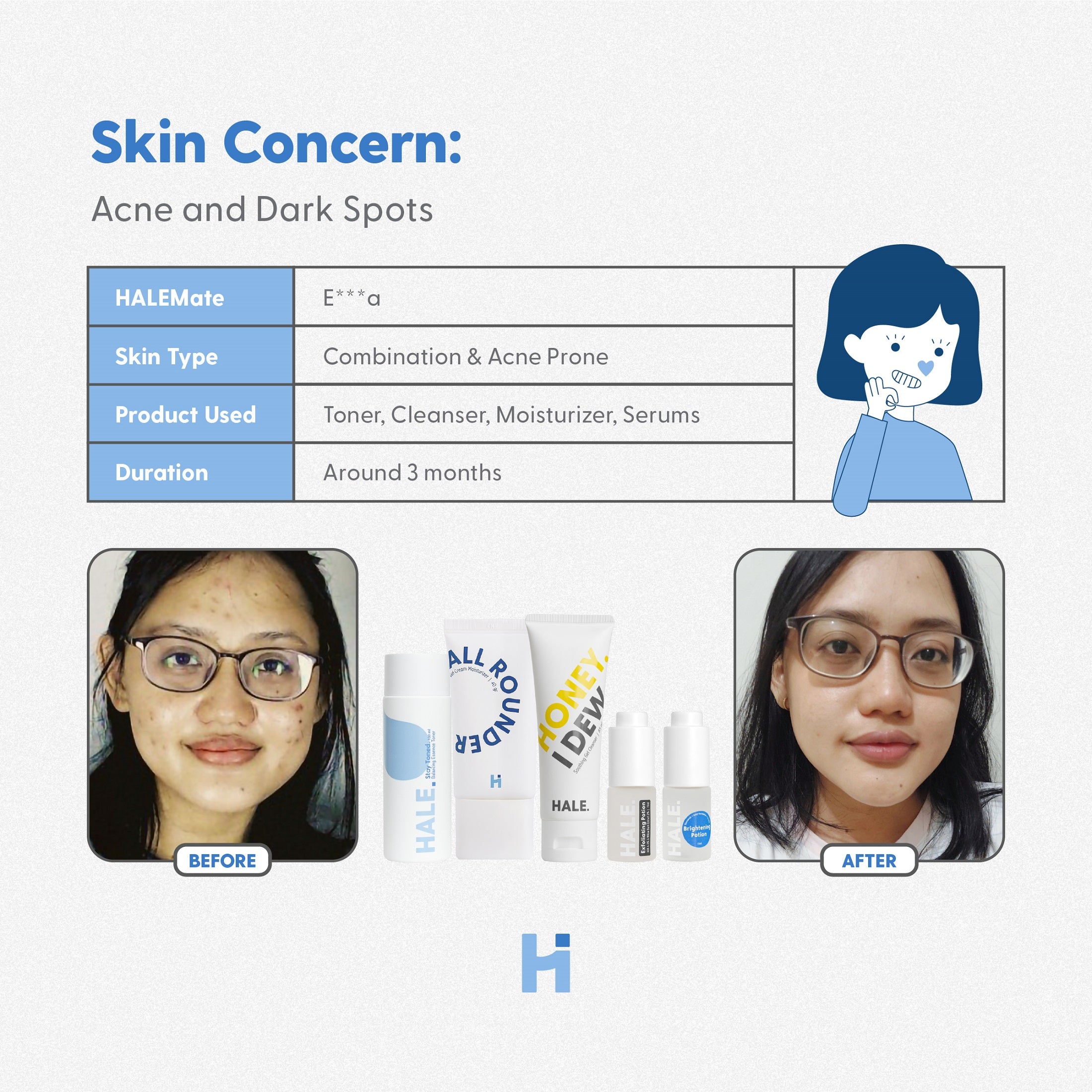 HALE All Rounder Gel Cream Moisturizer – HALE.